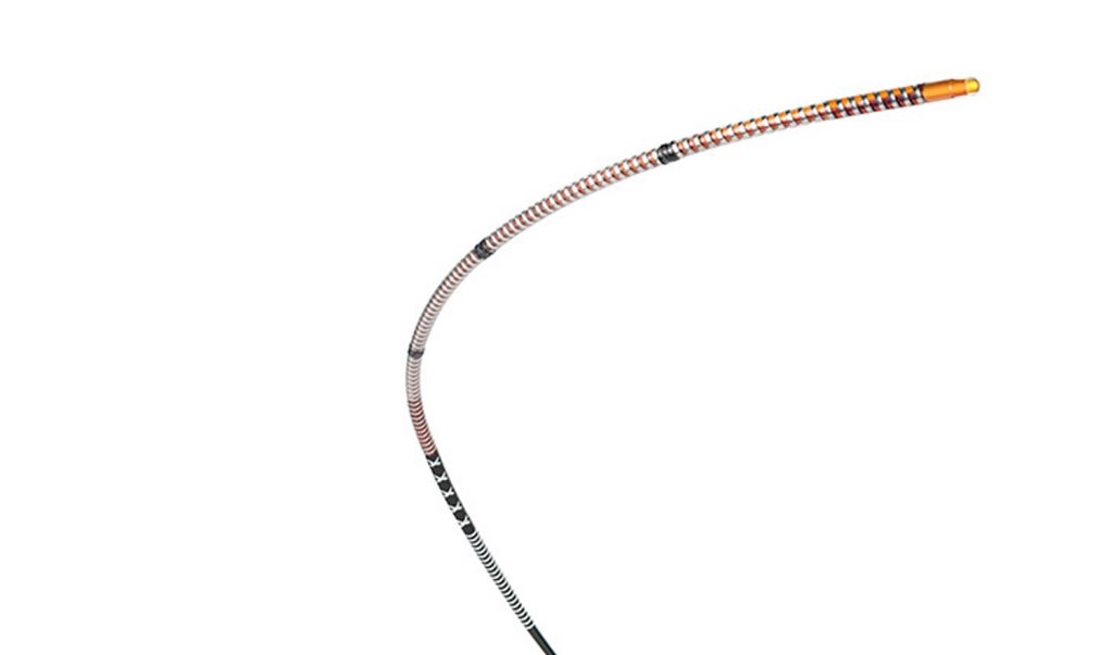 Radiofrequency Ablation RFA | Varicose Veins Treatment Sydney